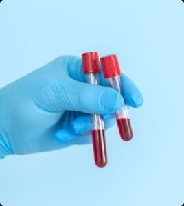 Understanding Penile Discharge in Men: Causes and Treatment